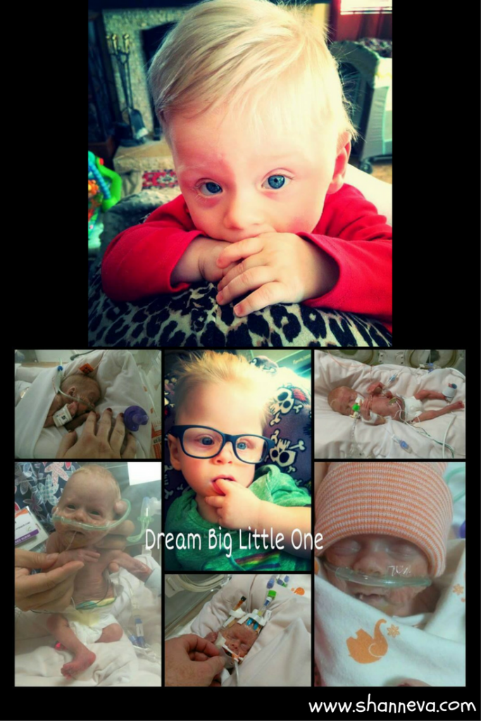 Micro Preemie Update: Lucky and Adiana - Shann Eva's Blog