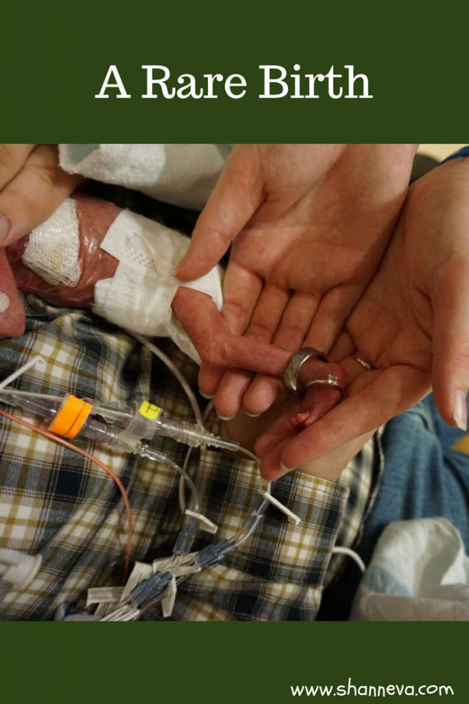 A Rare Birth: Charlie's Story - Shann Eva's Blog