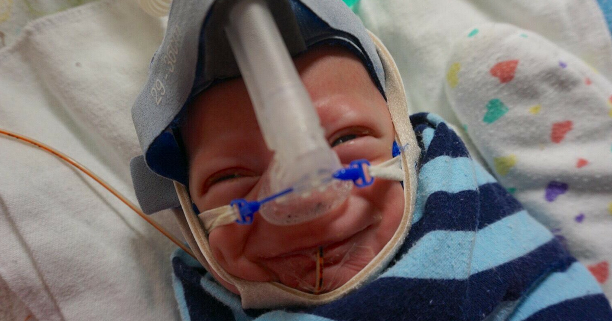 A Rare Birth: Charlie's Story - Shann Eva's Blog